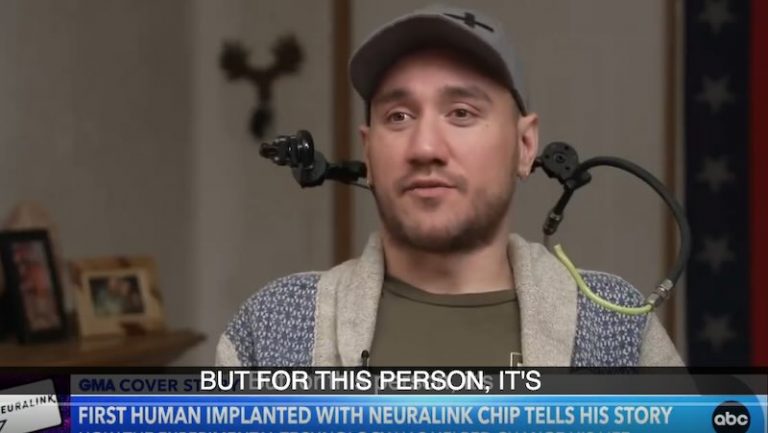 Neuralink Second Brain Chip Implant: A Leap Forward in Neural Interface ...